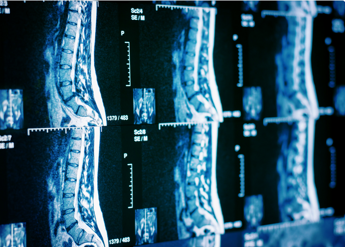 Magnētiskās rezonanse mugurkaula kakla, krūšu, jostas/krustu daļai
